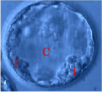 Overview of the Blastocyst development and grading ( along with Images)