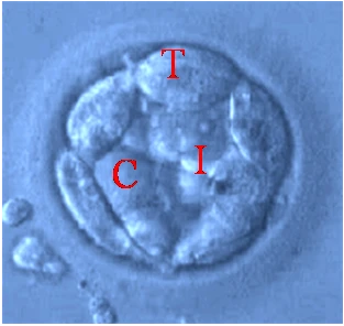 Overview of the Blastocyst development and grading ( along with Images)