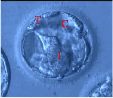 Overview of the Blastocyst development and grading ( along with Images)
