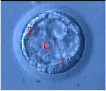 Overview of the Blastocyst development and grading ( along with Images)