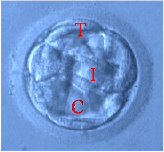 Overview of the Blastocyst development and grading ( along with Images)