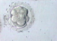 Embryos - An atlas for IVF patients | Malpani Infertility Clinic, Mumbai