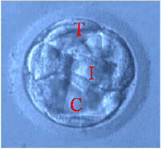 Overview of the Blastocyst development and grading ( along with Images)