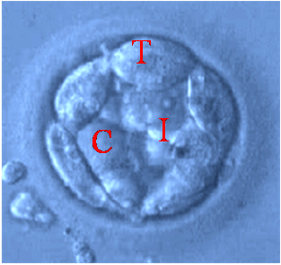 Overview of the Blastocyst development and grading ( along with Images)