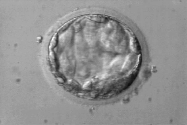 Embryos - An atlas for IVF patients | Malpani Infertility Clinic, Mumbai