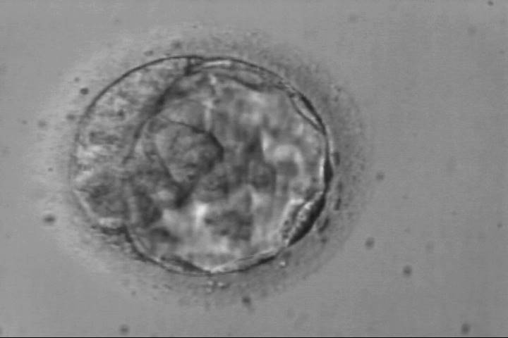 Embryos - An atlas for IVF patients | Malpani Infertility Clinic, Mumbai