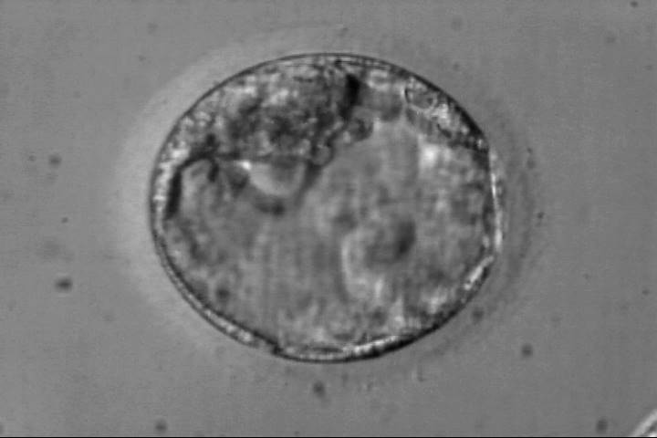 Embryos - An atlas for IVF patients | Malpani Infertility Clinic, Mumbai