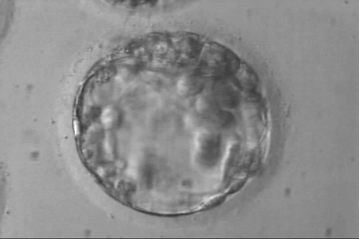 Embryos - An atlas for IVF patients | Malpani Infertility Clinic, Mumbai