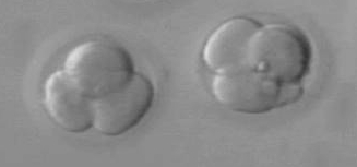 Embryos - An atlas for IVF patients | Malpani Infertility Clinic, Mumbai