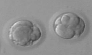 Embryos - An atlas for IVF patients | Malpani Infertility Clinic, Mumbai