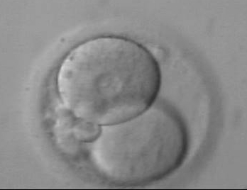 Embryos - An atlas for IVF patients | Malpani Infertility Clinic, Mumbai