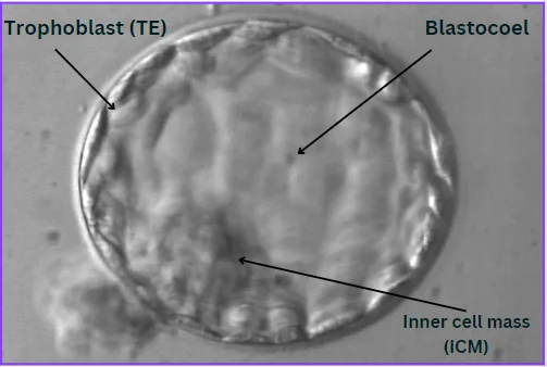 Embryo Grading in IVF Made Simple: What You Need to Know