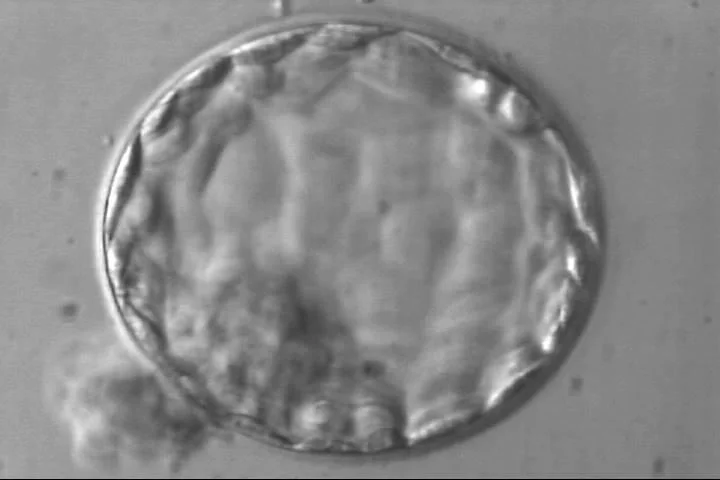 Embryo Grading in IVF Made Simple: What You Need to Know