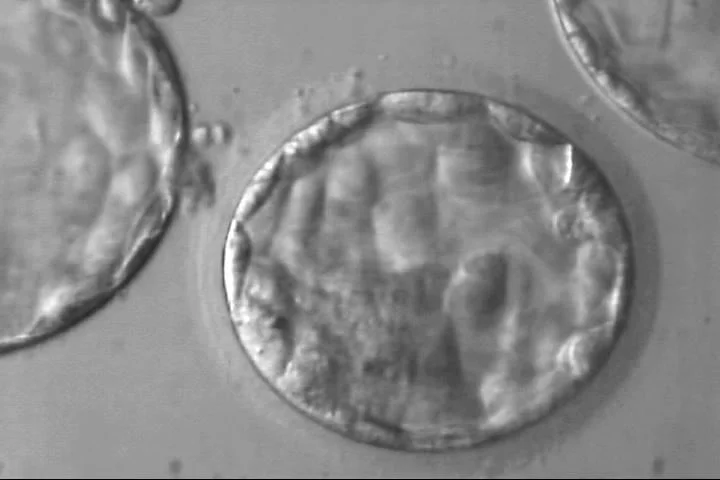 Embryo Grading in IVF Made Simple: What You Need to Know