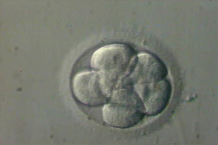 Embryos - An atlas for IVF patients | Malpani Infertility Clinic, Mumbai