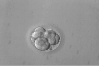 Embryos - An atlas for IVF patients | Malpani Infertility Clinic, Mumbai