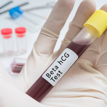 What IVF patients need to know about the HCG blood test